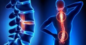 How Spine Neurosurgeons Assess and Treat Spinal Cord Injuries